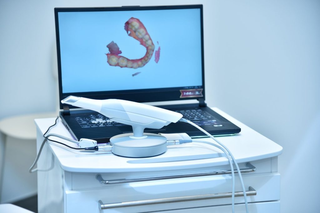 iTero Dental Scanner: How iTero Scanners Are Changing the Dental Experience